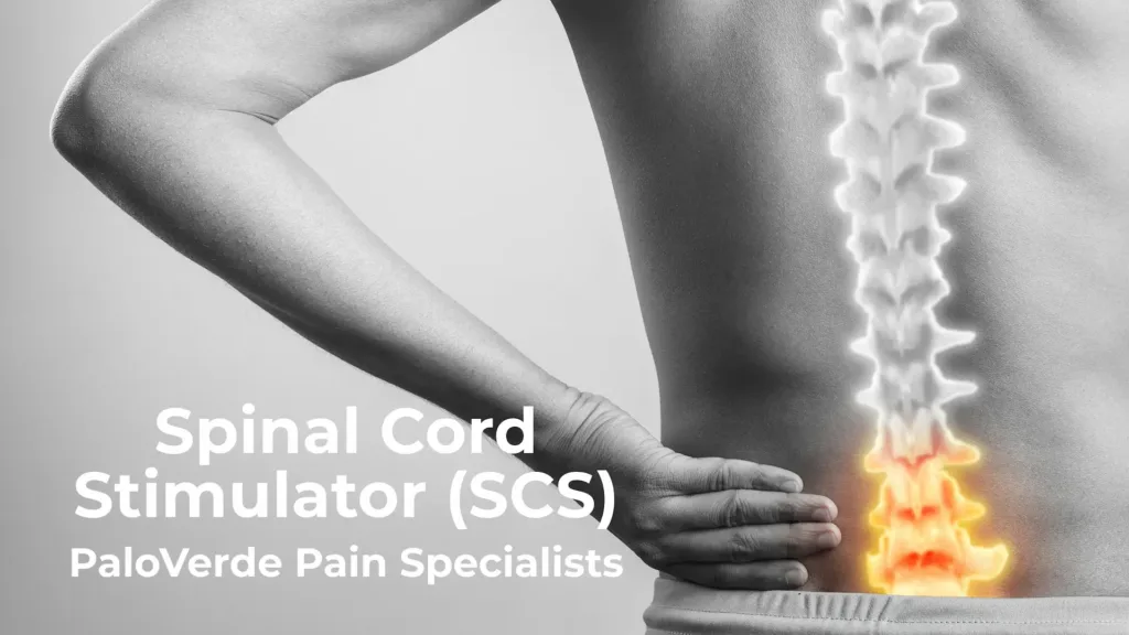 The Benefits Of Spinal Cord Stimulator Treatment @ PaloVerde Pain ...